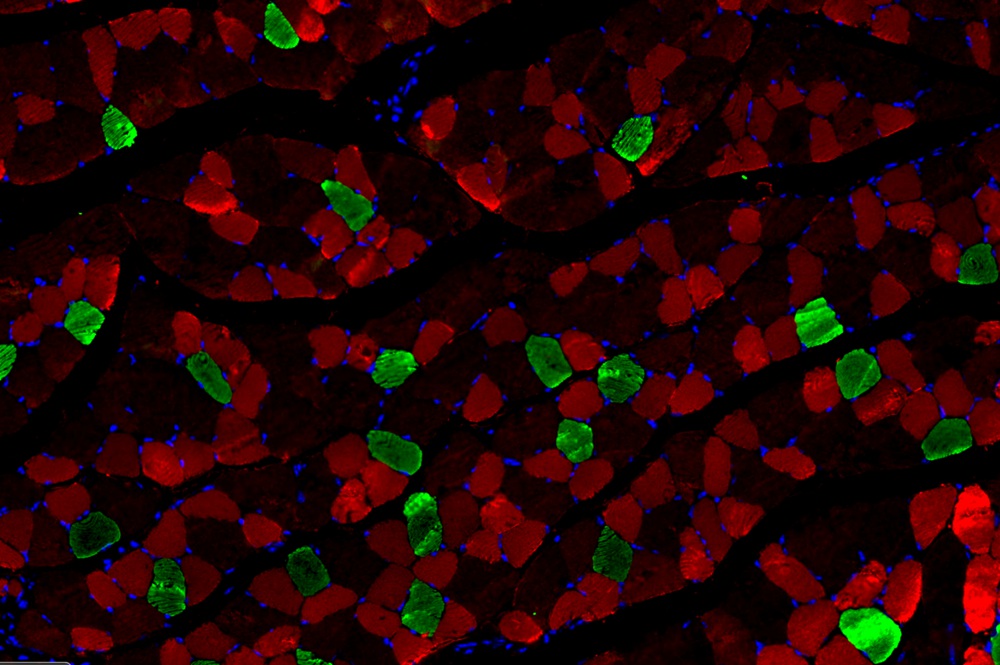 CY3-Tyramide Tyramide Signal Amplification Immunofluorescence Reagent ...