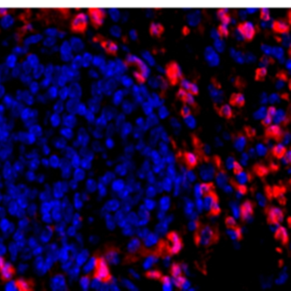 GB11551 Anti -cPLA2 PLA2G4A PLA2G4 Alpha Rabbit PAb Antibody from China ...